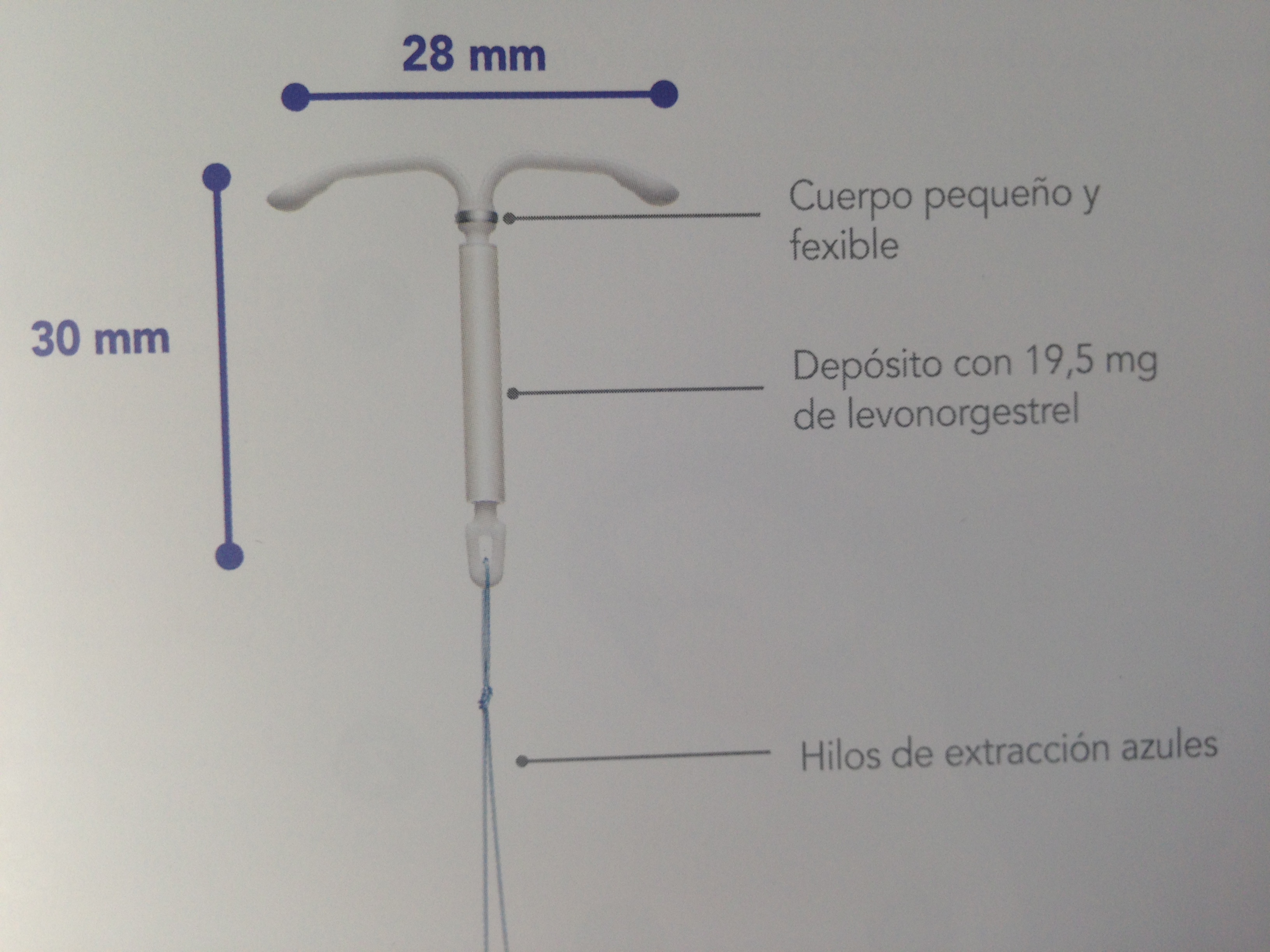 DIU HORMONAL: KYLEENA. – Dr. Francisco Valdivieso