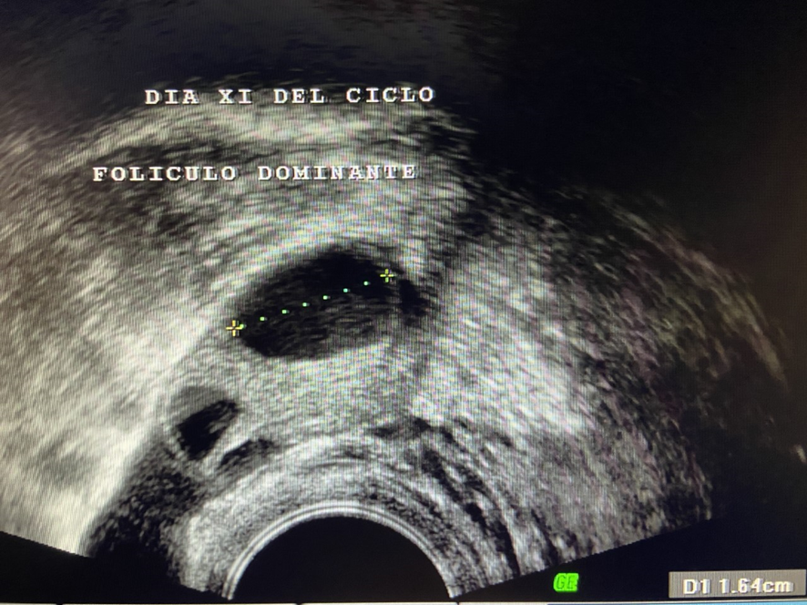 CICLO MENSTRUAL. Fase folicular-Proliferativa. (2ª parte). – Dr ...