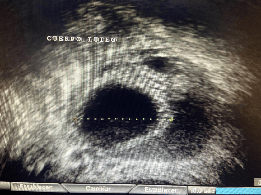 CICLO MENSTRUAL. Fase lútea o secretora. (1ª parte). – Dr. Francisco ...